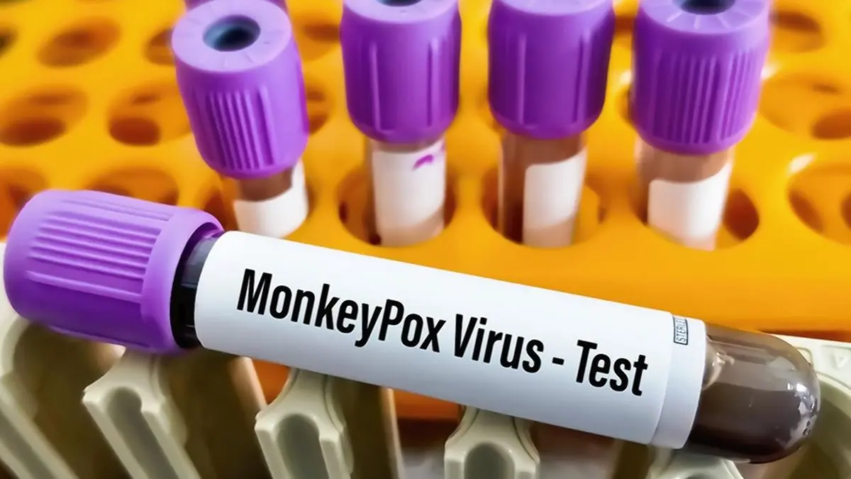 India to enhance lab capacities for monkeypox testing - The ...