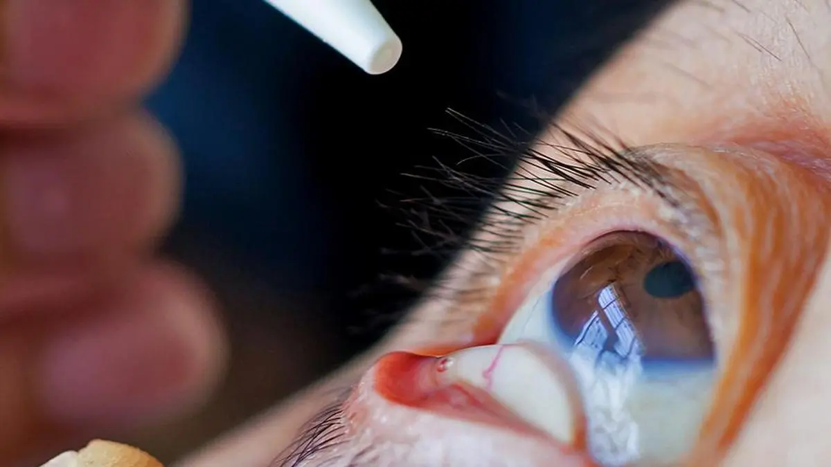 Alembic Pharmaceuticals gets USFDA nod for generic eye infection ...