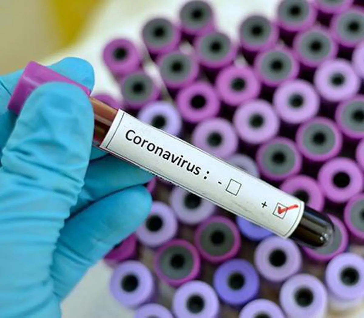 Covid 19 In India Death Toll Rises To 1 886 Cases Climb To 56 342
